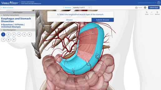 How to Teach the Digestive System with Visible Body Courseware