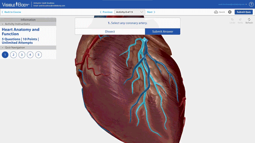 Lesson Plan: Heart Failure with Visible Body Courseware