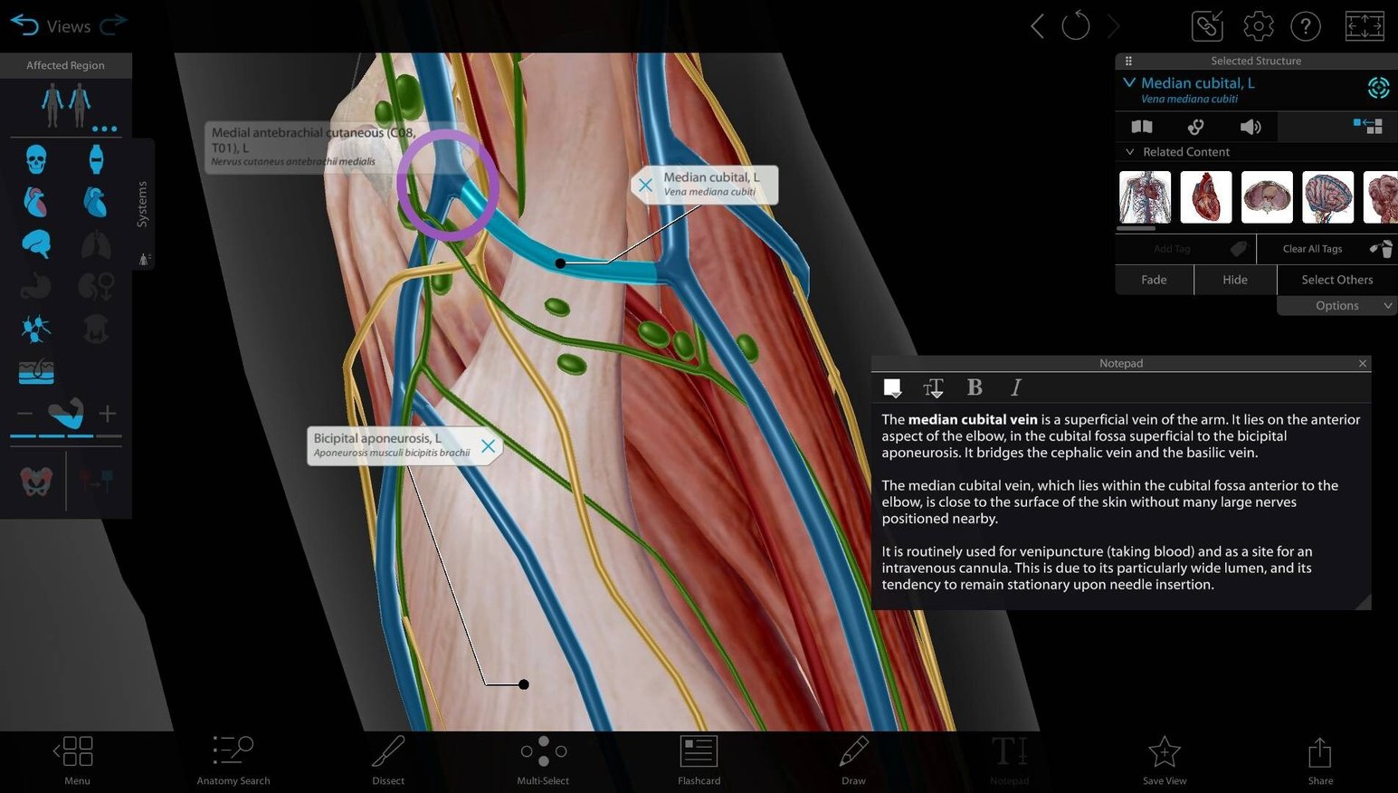 A&P for Phlebotomy: A Visible Body Lesson Plan