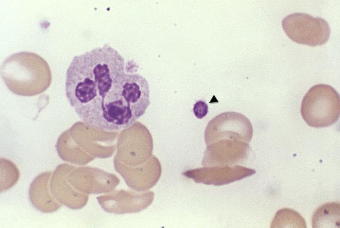 Behind the Scenes of Visible Biology: Bringing the Blood Cell Lab into ...