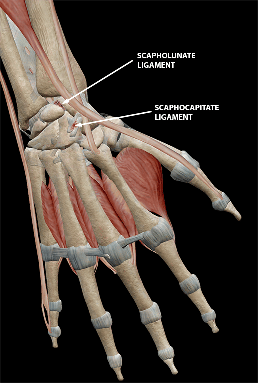 Just RICE It: The Anatomy and Pathology of Sprains