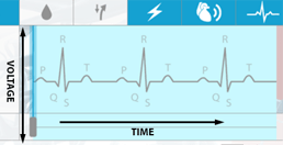 Decoding the Heart: What Is an ECG?