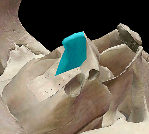 3D Skeletal System: Five Things to Know about the Ethmoid Bone