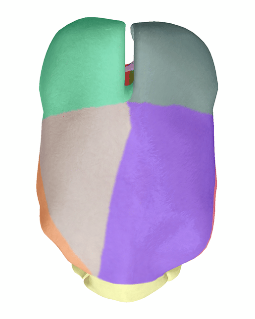 Studying the Peritoneum with VB Suite