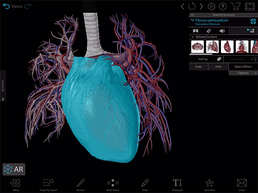 That Boom Boom Pow: Virtual Dissection (sort of) of the Human Heart