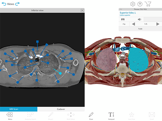 Free Lesson Plan: Anatomical Planes, Positions, and Directional Terms