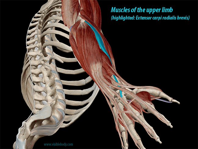 Stop Making a Racquet: A Look at Lateral Epicondylitis (Tennis Elbow)