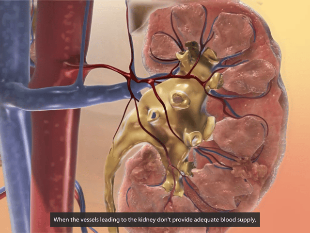 Exploring Kidney Pathologies with Physiology & Pathology