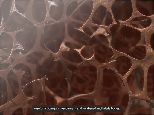 Exploring Skeletal and Muscular System Pathologies with Physiology ...