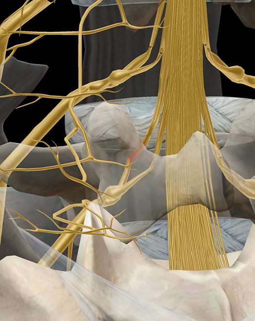 A Real Pain in the Butt: The Anatomy and Pathology of Sciatica