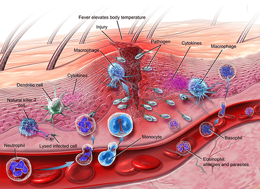 VB News Desk: The Double Danger of Measles