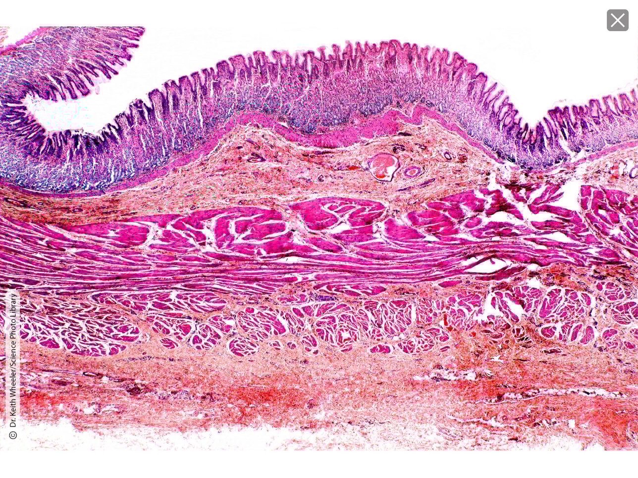 New: Human Anatomy Atlas 2023＋, Where 3D Visualization Meets 2D Realism!