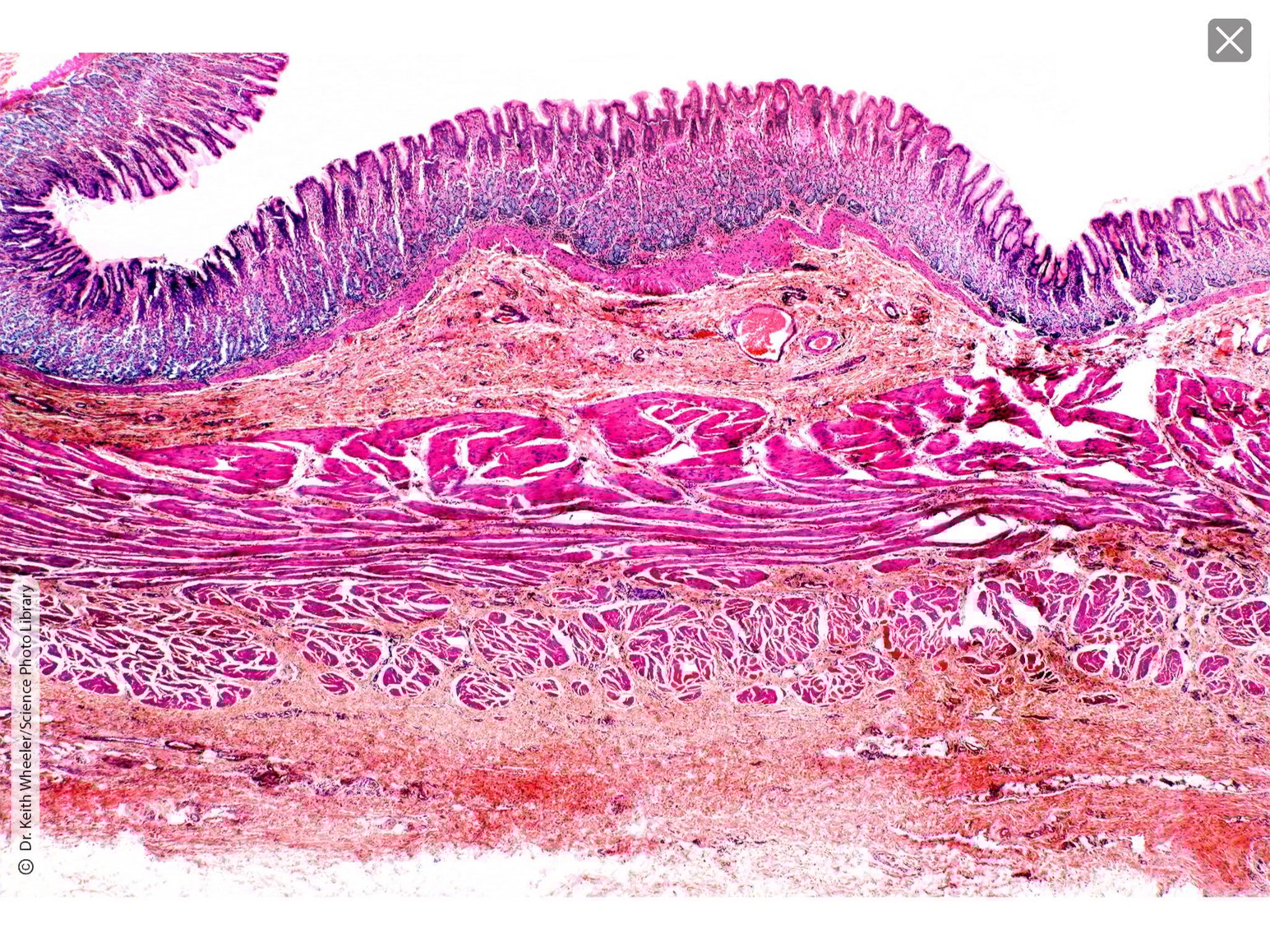 New: Human Anatomy Atlas 2023＋, Where 3D Visualization Meets 2D Realism!