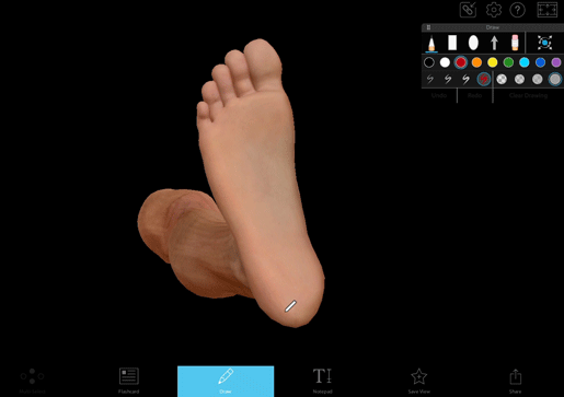 How Abnormal Reflexes Can Indicate Pathologies