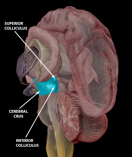 A Lot on Our Minds Part 2: Digging Deeper