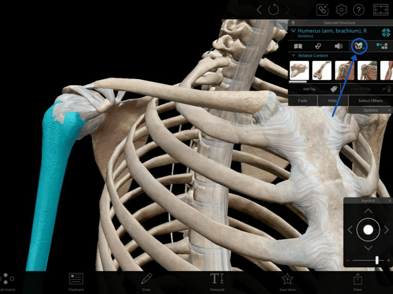 From Anatomy to Pathology: A Shoulder Region Lesson Plan in 3D and AR