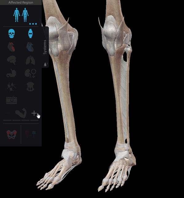 Enhanced Systems Tray Makes Navigating Anatomy Even Easier