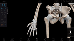 Enhanced Systems Tray Makes Navigating Anatomy Even Easier