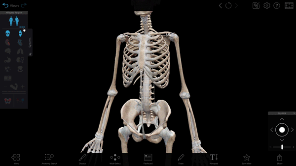 Enhanced Systems Tray Makes Navigating Anatomy Even Easier