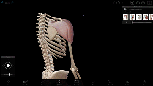 How to Teach Rotator Cuff Injuries with VB Suite