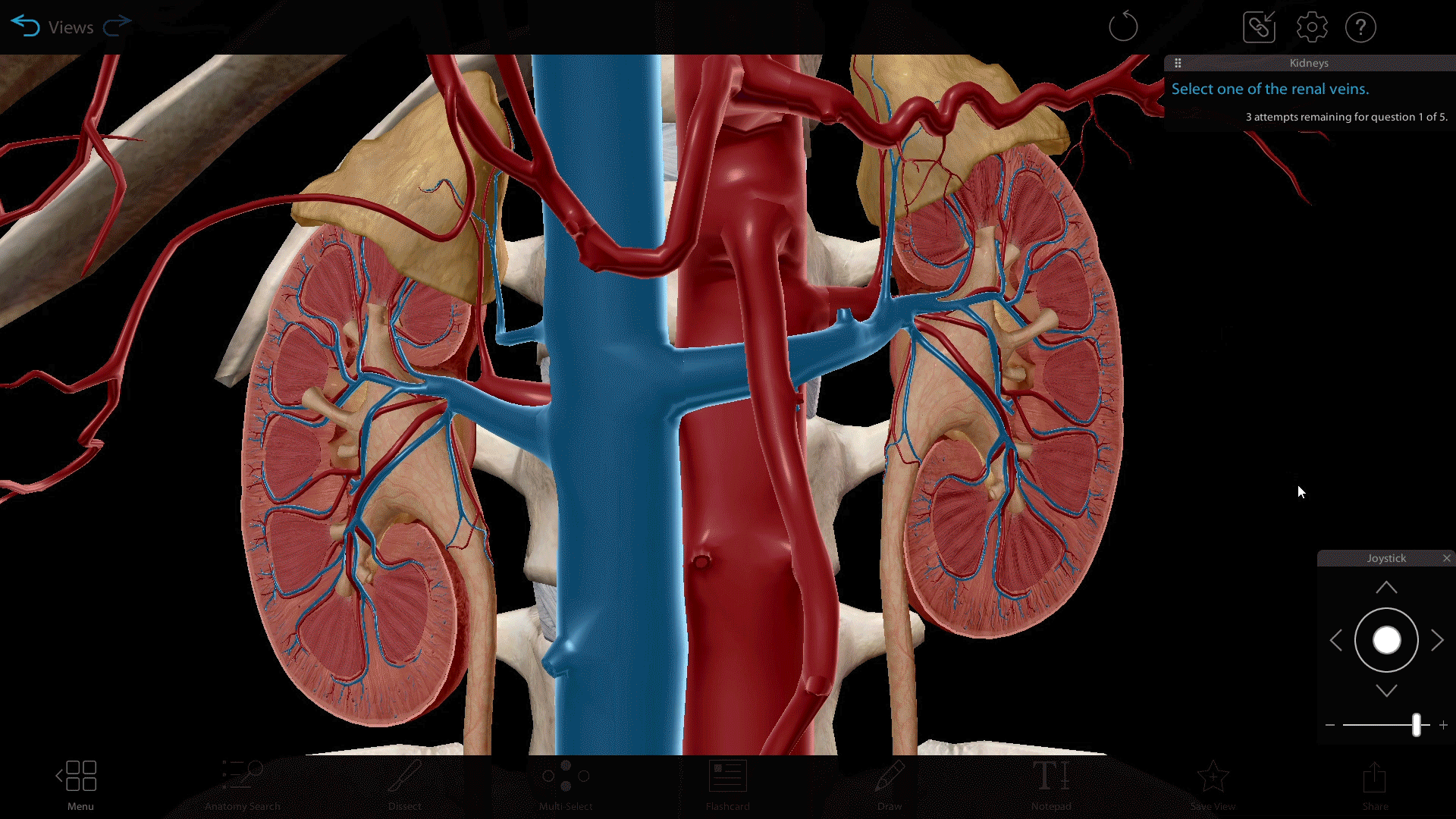 3D Urinary System Lesson Plan with Visible Body