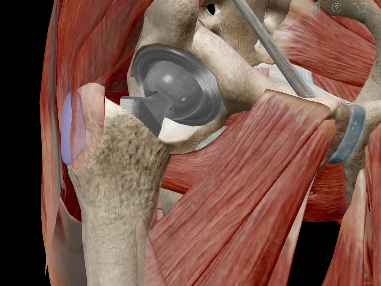 Hip, Hip, Hooray: Understanding Hip Osteoarthritis and Hip Replacements